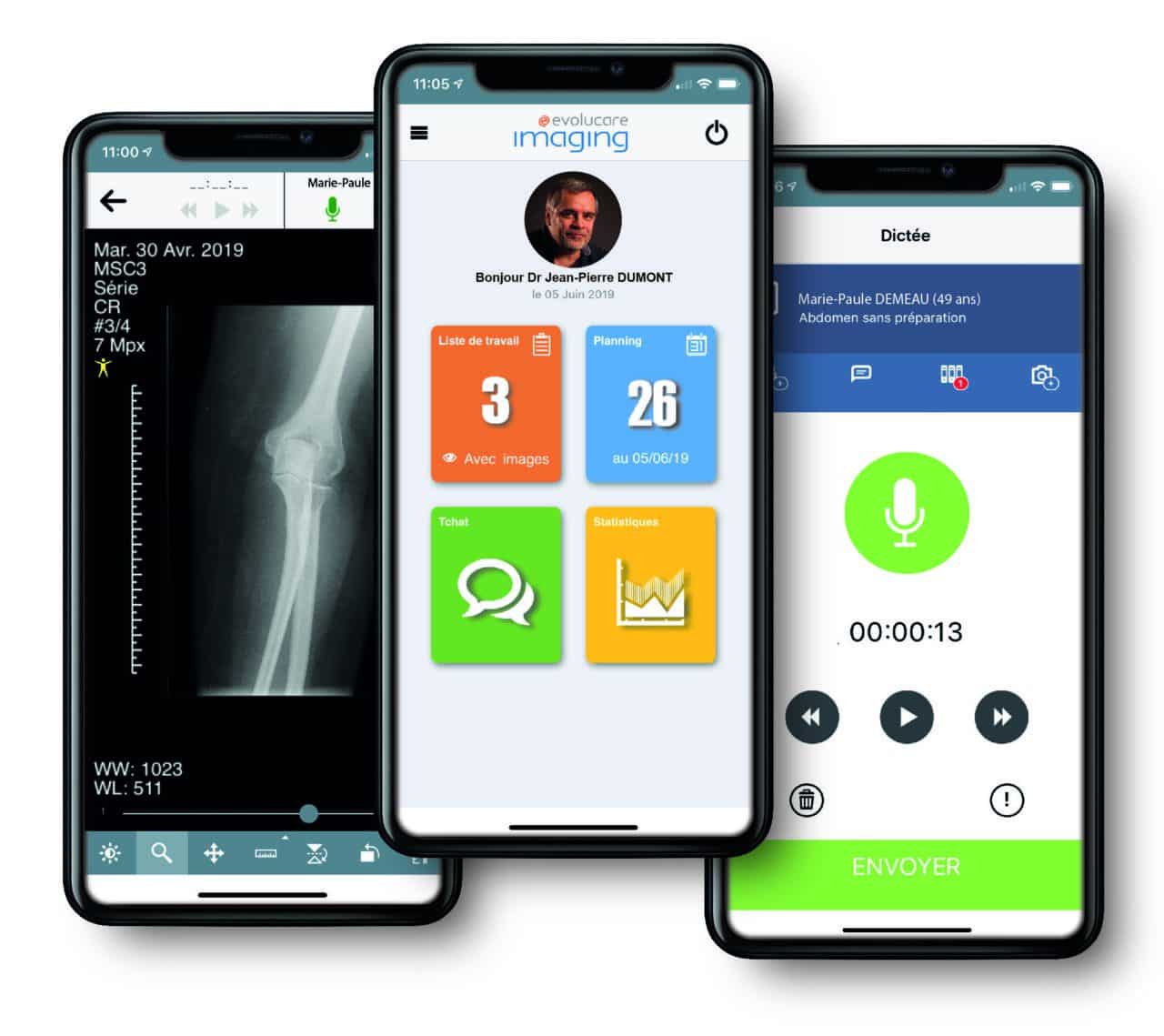 Evolucare Imaging entwickelt die mobile Toolbox für Radiologen — Evolucare