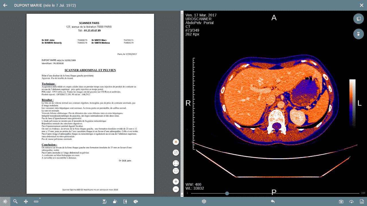 Evolucare uView : the new ZFP certified diagnostic viewer — Evolucare
