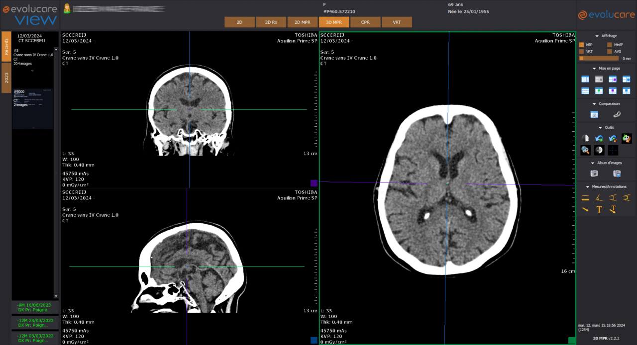 Evolucare uView : the new ZFP certified diagnostic viewer — Evolucare
